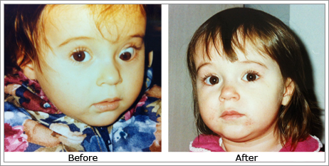 Untitled Document [www.alanchowmd.com]